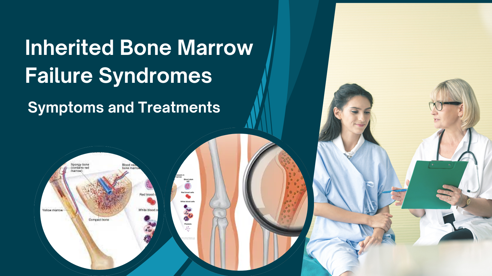 Inherited Bone Marrow Failure Syndromes: Types, Symptoms, and Treatments